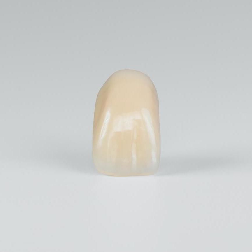 Prótesis dental de PMMA - PhysioStar NFC+ - Candulor - de los dientes ...