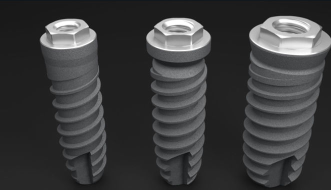 Implante dental cilíndrico / de titanio / hexágono externo - KL - KLOCKNER, S.A.