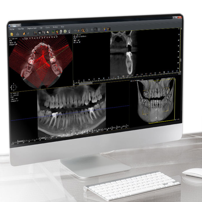 Software de análisis - QuickVision 3D - Owandy Radiology - de ...