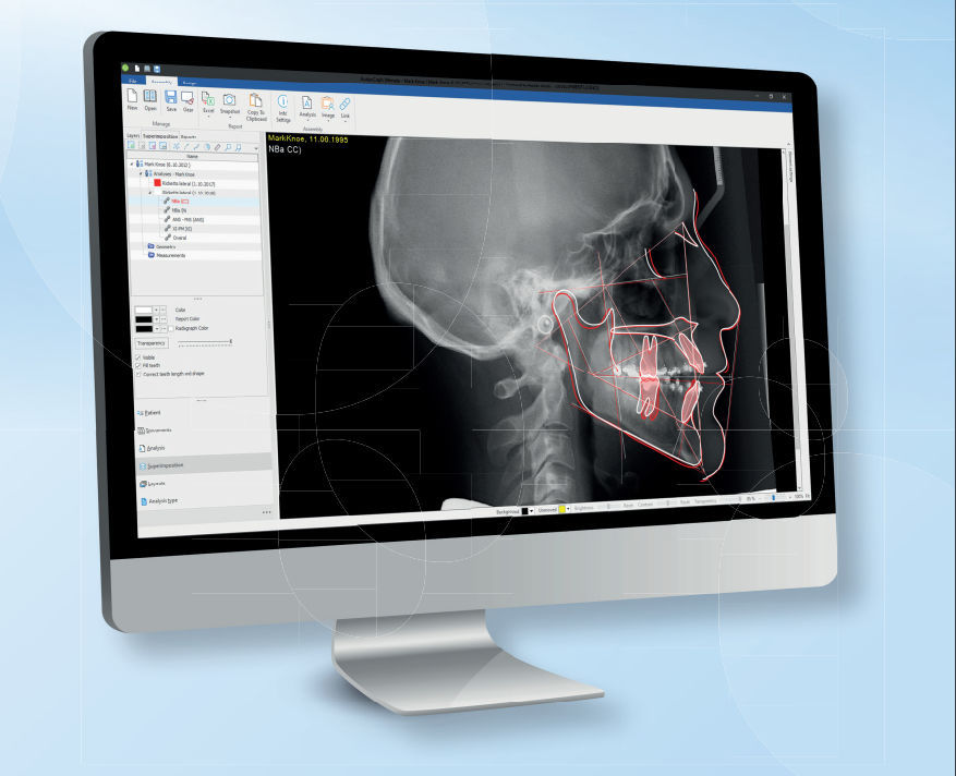 Módulo de software para odontología - CephAnalysis - Owandy Radiology - de análisis ...