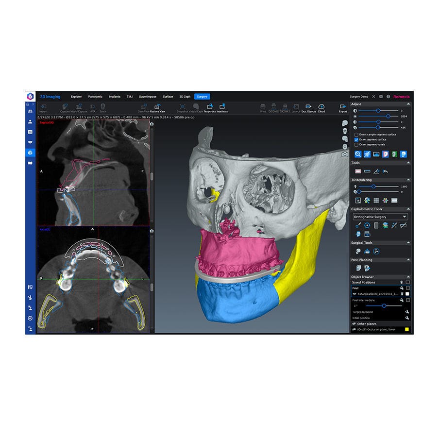Software de análisis cefalométrico - Romexis® - Planmeca - de planificación de tratamiento ...