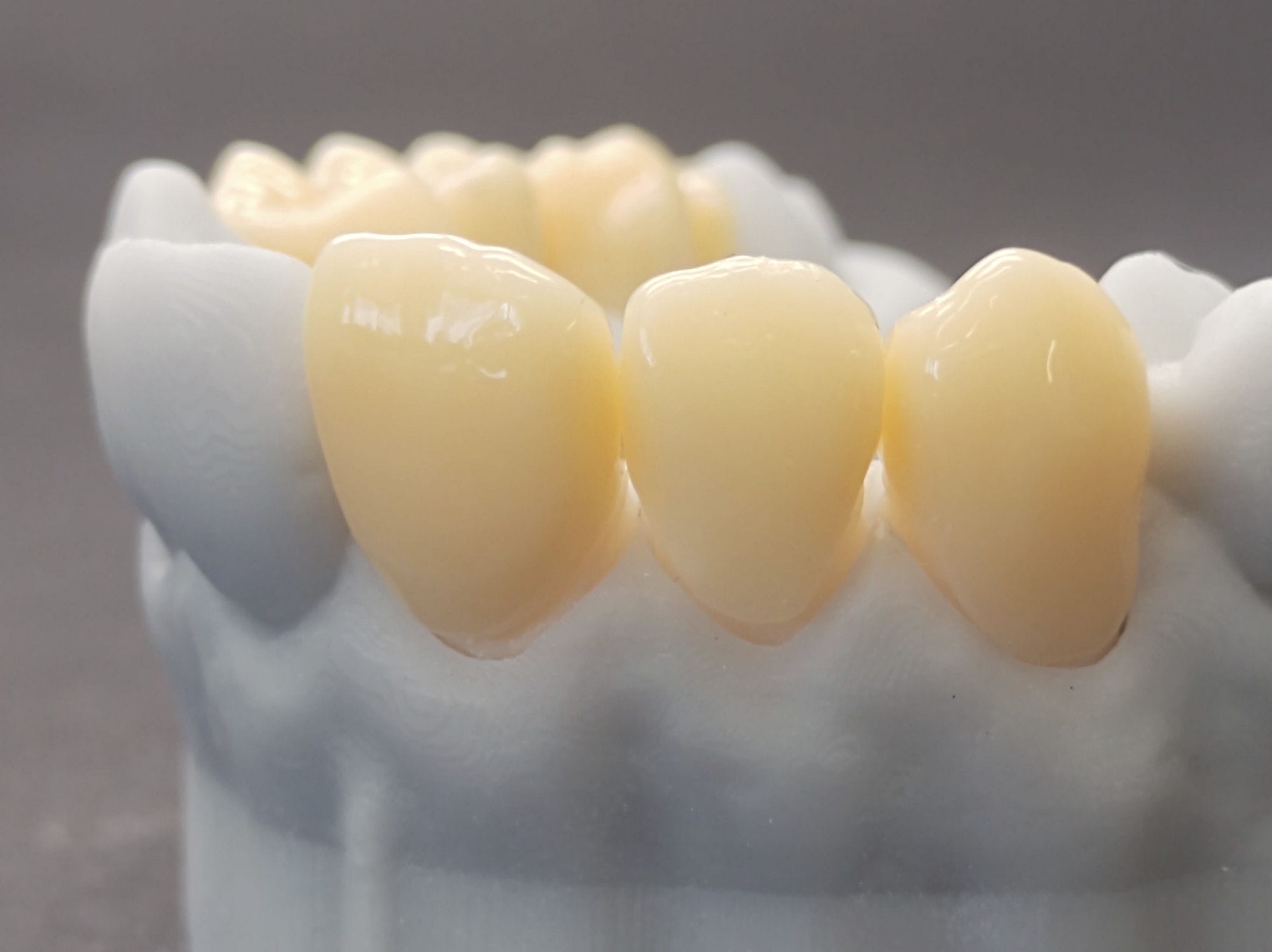 Material dental de PMMA - CORiTEC temp - pritidenta GmbH - para ...