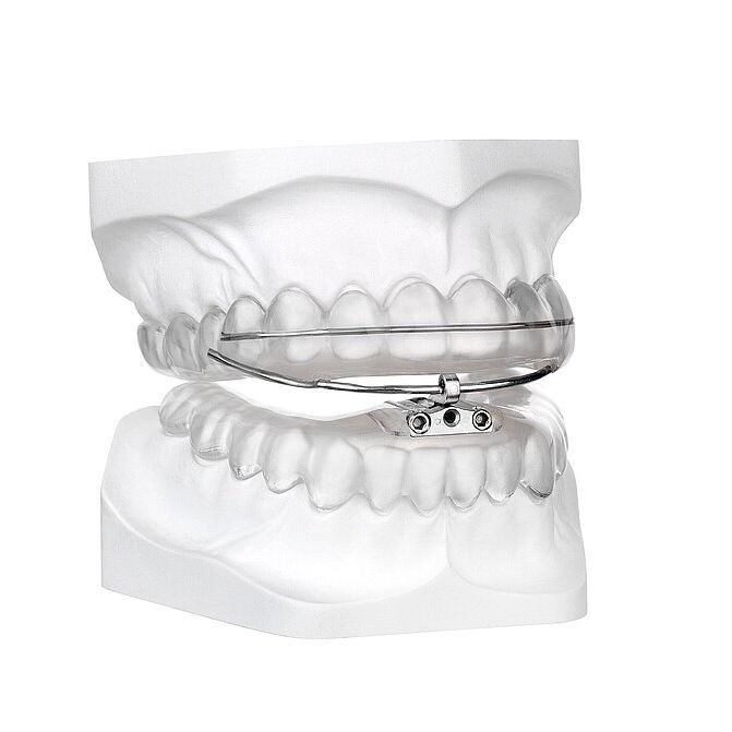 Férula dental - dreamTAP™ - Scheu-Dental GmbH