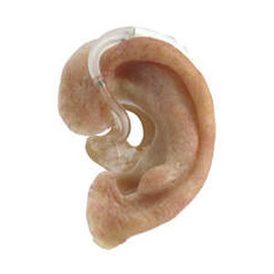 Prótesis estética esterna auricular - The Anaplastology Clinic - para ...