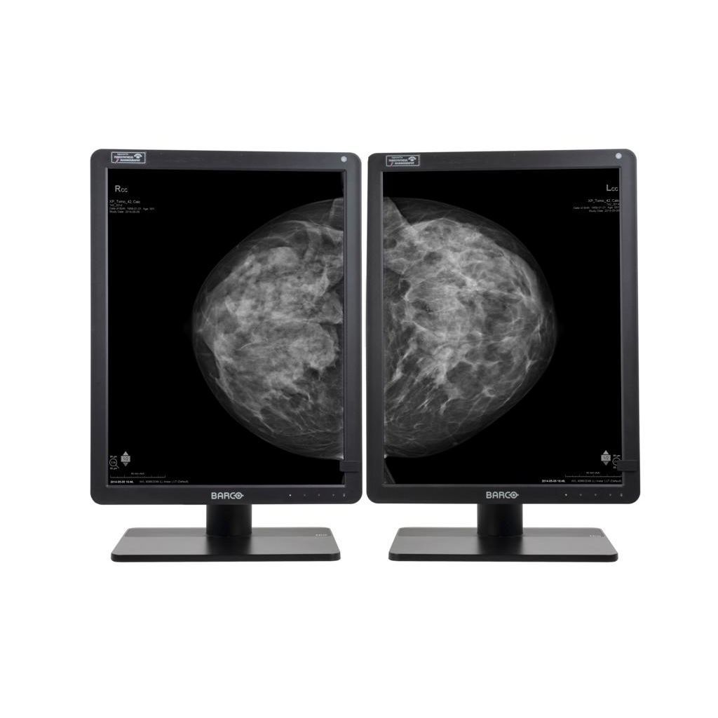 Monitor de radiología - MDNG-6221 - Barco - mamográfico / 21.3" / LCD