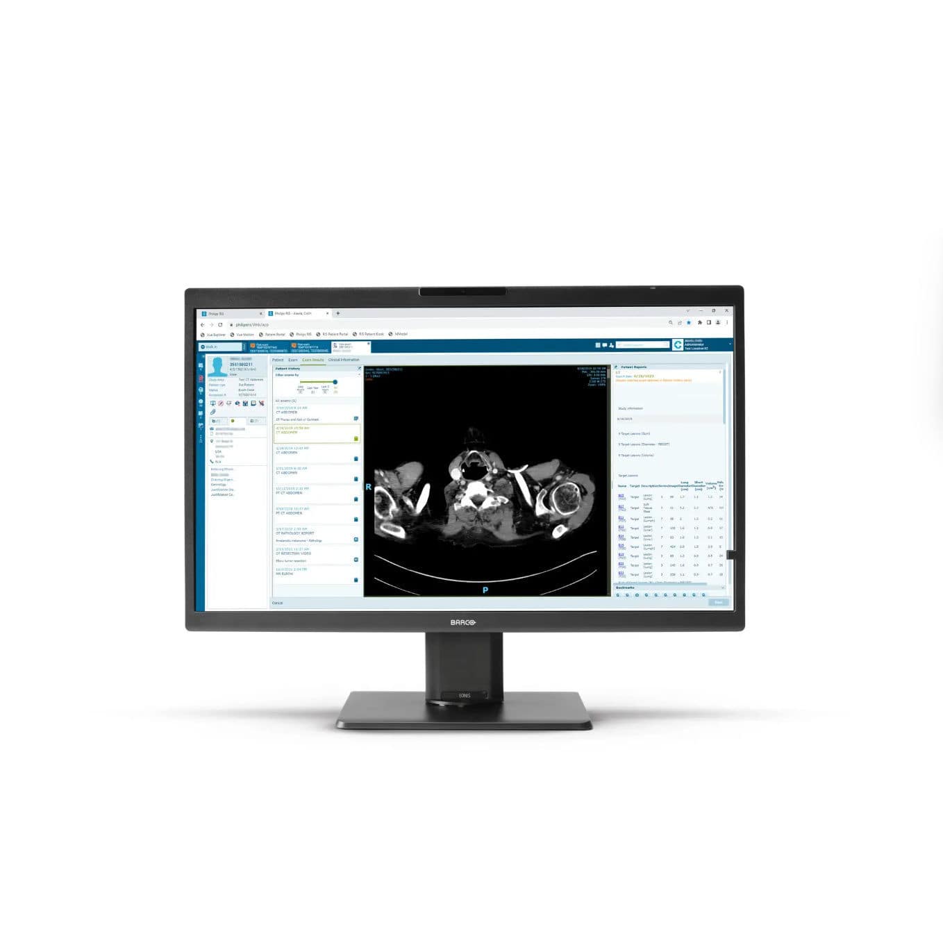 Monitor 32" - MDRC‑8132 - Barco - a distancia / 16:9 / DisplayPort