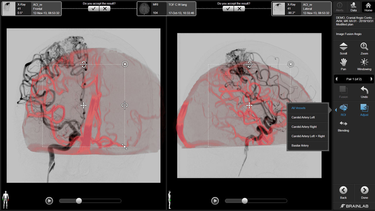 Software de visualización 3D - Brainlab - de diagnóstico / de tratamiento / médico
