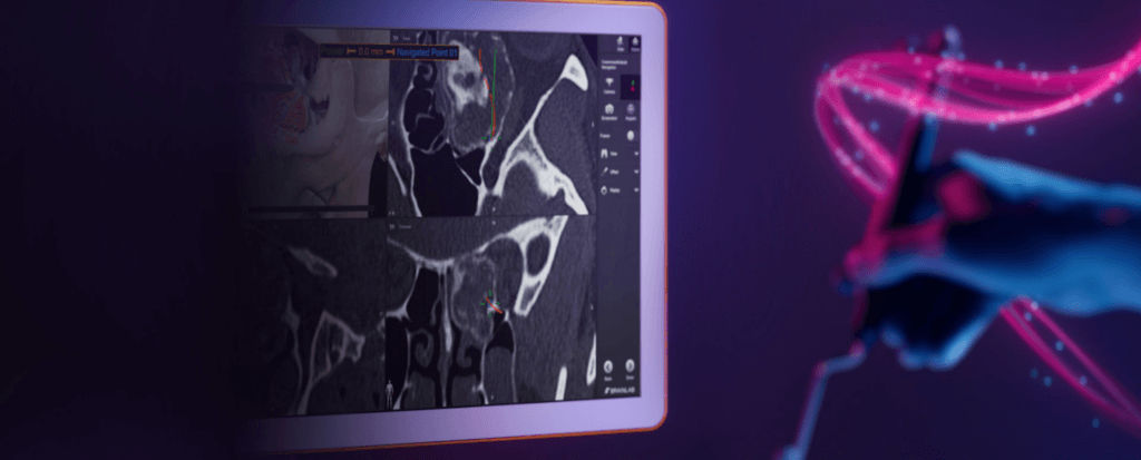 Software de navegación - Brainlab - de verificación / médico / TDM