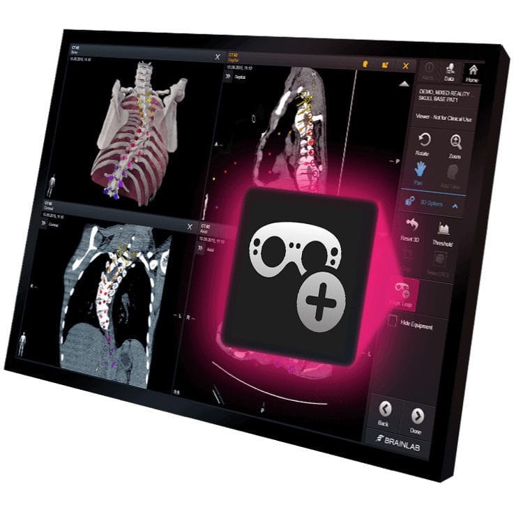 Software visualizador - Brainlab - de educación / médico / para quirófano