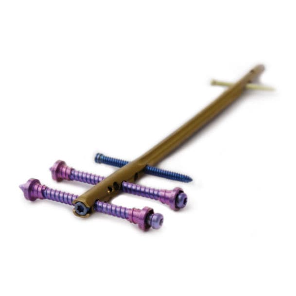 Clavo intramedular para fémur - CHARFIX2 - ChM - fijación distal / de ...