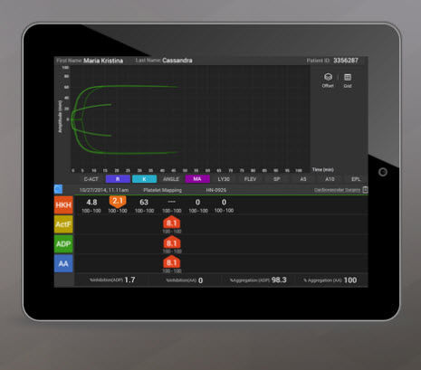 Software de análisis / de gestión de datos / de visualización / de ...