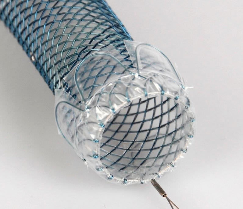 Stent esofágico - HV Stent Plus - ELLA-CS - de nitinol / de silicona ...