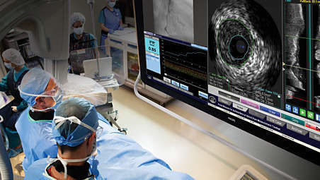 Catéter de acceso / de ecografía / de ecografía / vaso sanguíneo ...