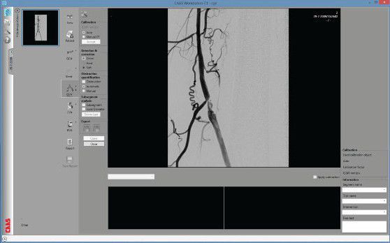 Software de angiografía - CAAS QVA - Pie Medical Imaging - de ...
