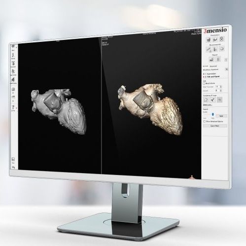 Software de captura - Pie Medical Imaging - de impresión 3D / TDM ...