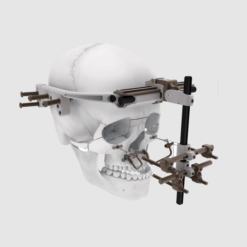 Distractor maxilar - Depuy Synthes - externo / pediátrico