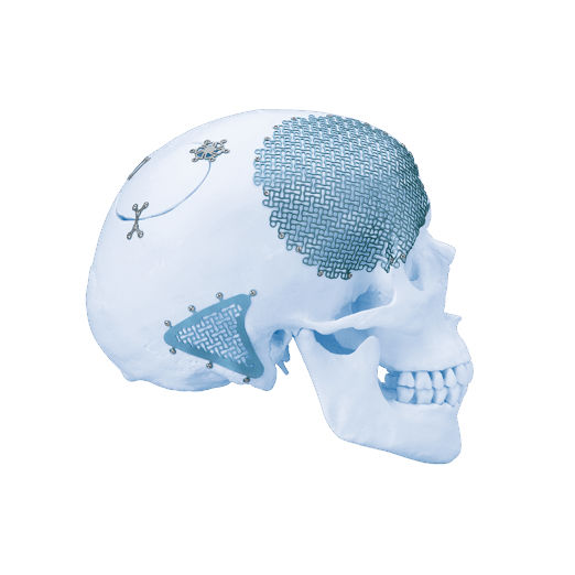 Implante craneal - MatrixNEURO™ - Depuy Synthes
