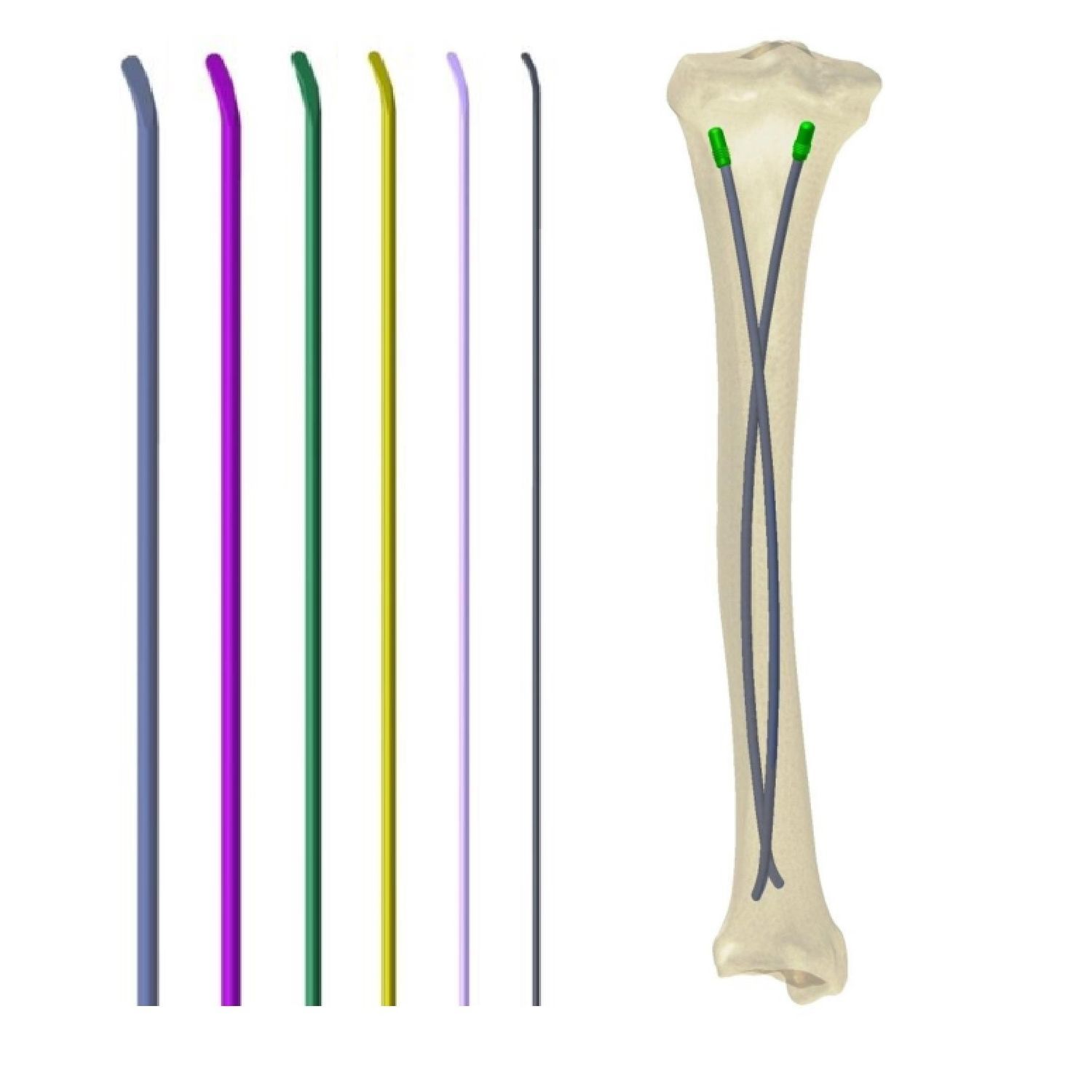 Clavo intramedular para fémur - Health-Joy Medical - para tibia / para ...