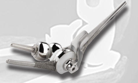 Prótesis total de codo cementada - LATITUDE EV™ - Wright Medical Technology