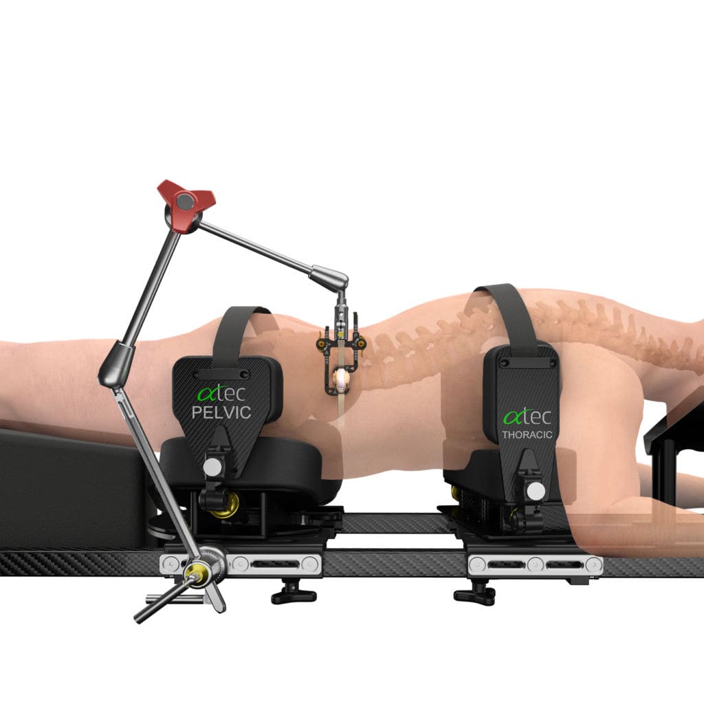 Soporte lateral para mesa de operaciones - PTP - Alphatec Spine