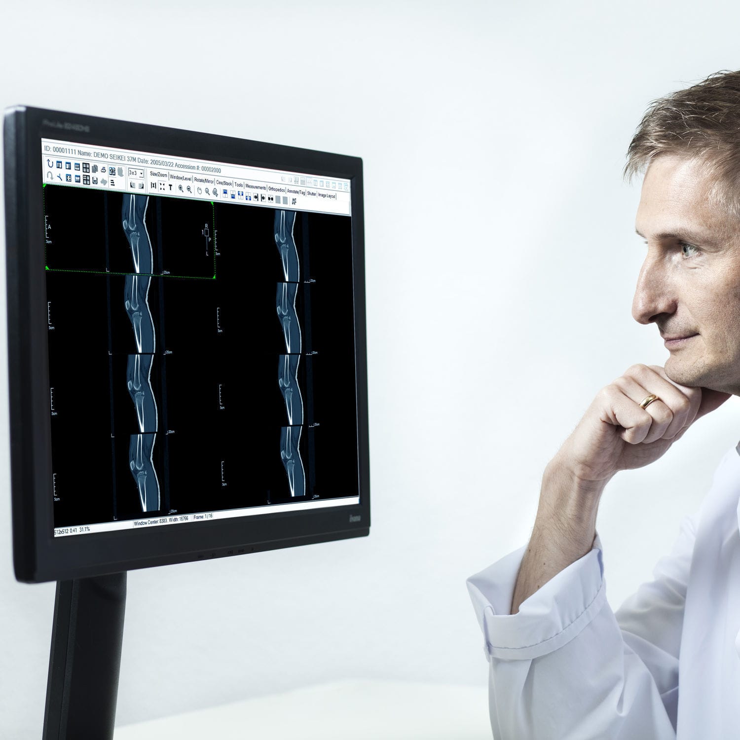 PACS para imágenes médicas - SoliPACS™ - EBM Technologies