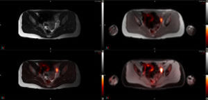 Software SPECT - MIM Encore™ - MIM Software - cardíaco / TEP / para ...