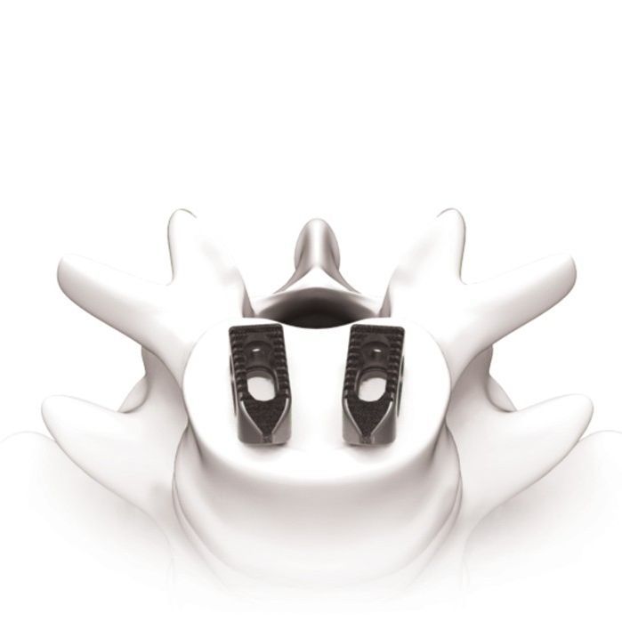 Caja intersomática toracolumbar - PLATEAU®-Ti - Life Spine - vía ...
