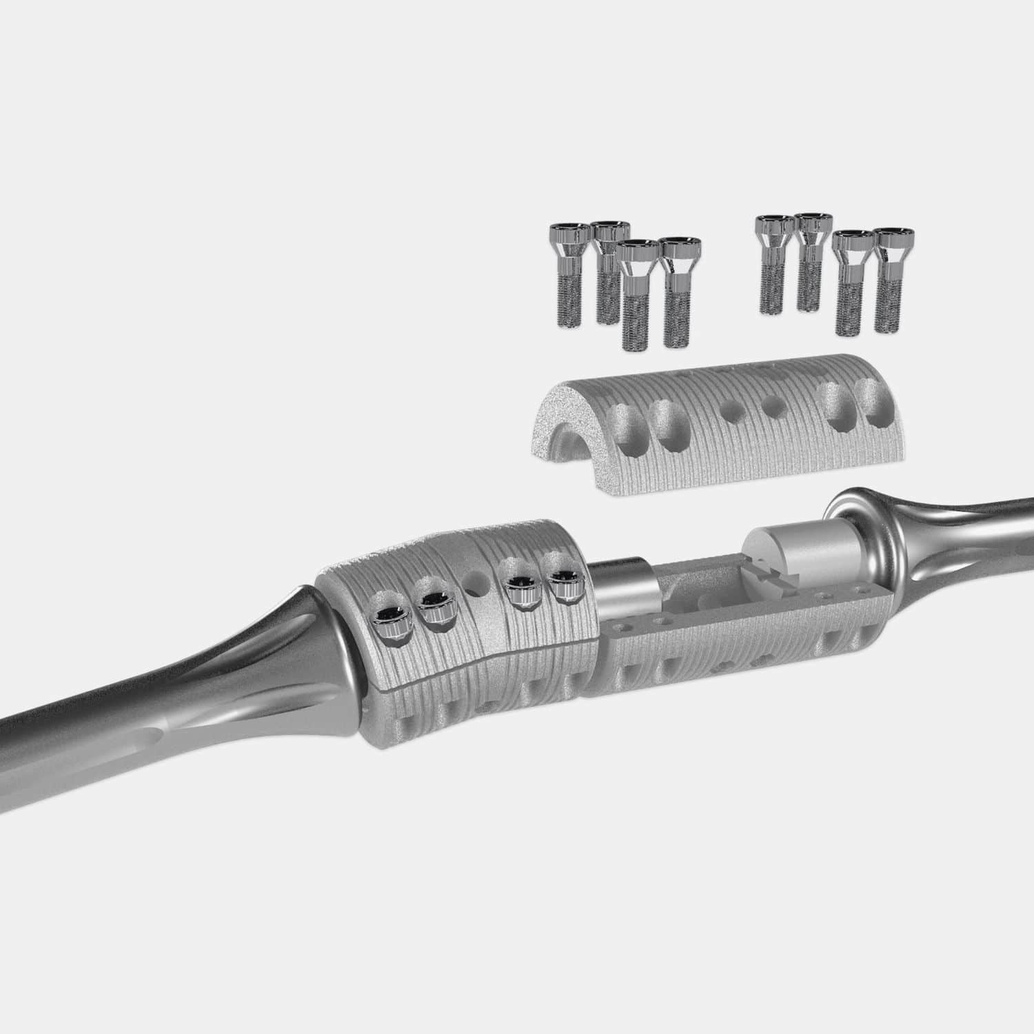 Clavo intramedular para fémur - OsteoBridge™ - Merete - para tibia ...