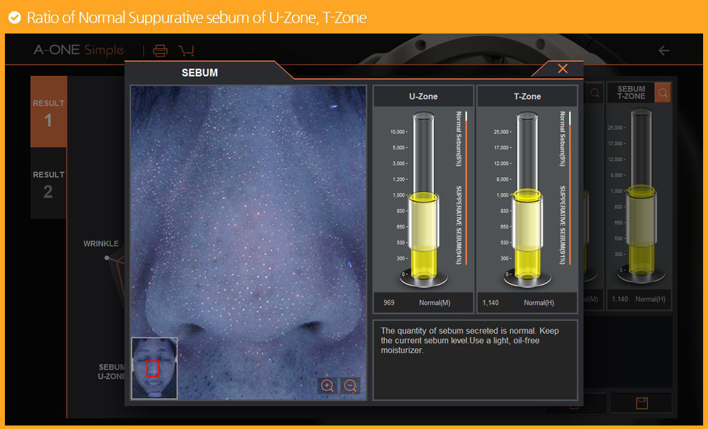 Analizador cutáneo nivel de hidratación cutánea - A-ONE Simple - Bomtech - sebo cutáneo ...