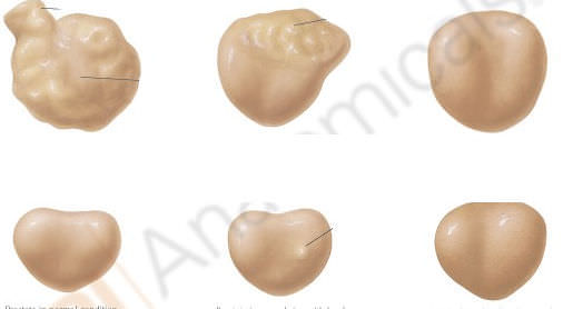 Modelo Anatómico Próstata 3000 Gpi Anatomicals De Formación