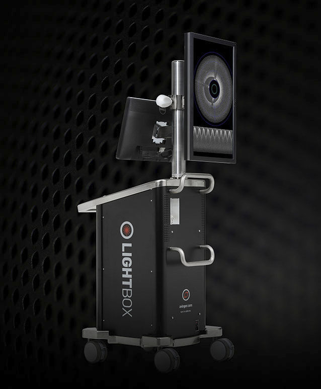 Sistema de imágenes endoscópicas OCT - Lightbox - Avinger - imágenes ...