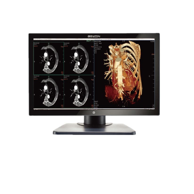 Monitor de diagnóstico - C61W+ - Shenzhen Beacon Display Technology ...