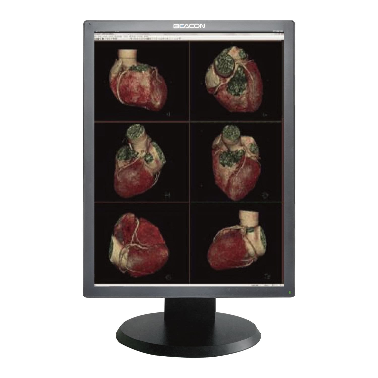 Monitor para imágenes médicas - C310S - Shenzhen Beacon Display ...