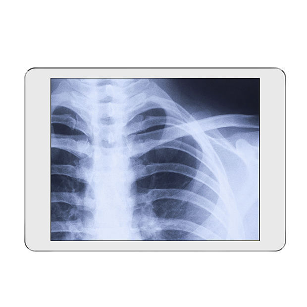 Sistema de adquisición para radiología - iRay DR - iRay Technology ...