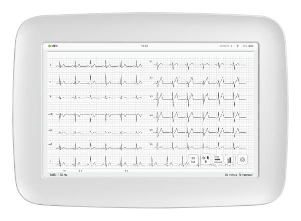 Electrocardiógrafo 12 canales - MESI mTABLET ECG - MESI - para tablet / inalámbrico