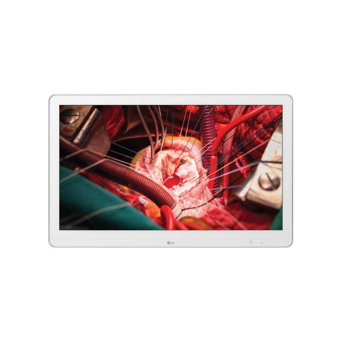 Monitor de diagnóstico - 27HK510S - LG - quirúrgico / Full HD / 1920 x 1080