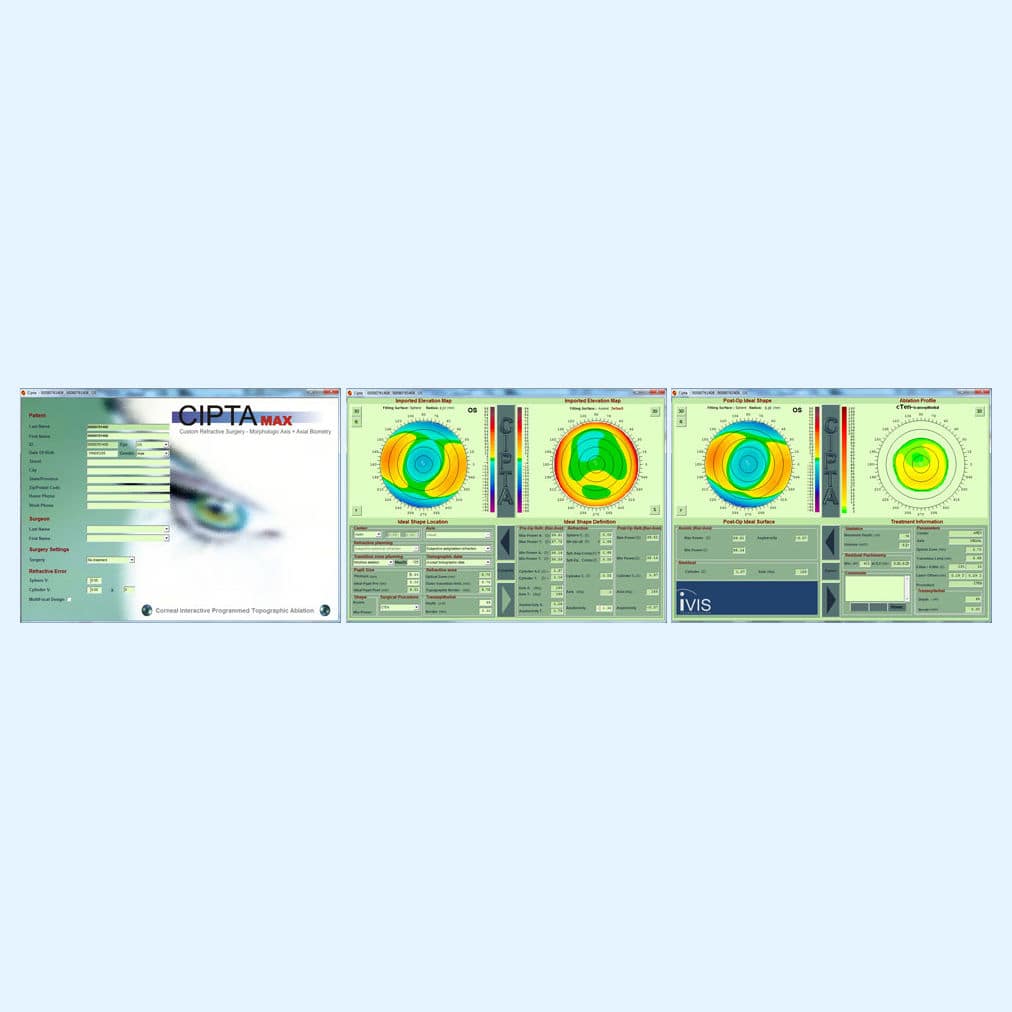 Software de planificación de tratamiento - CIPTA® - iVis Technologies ...