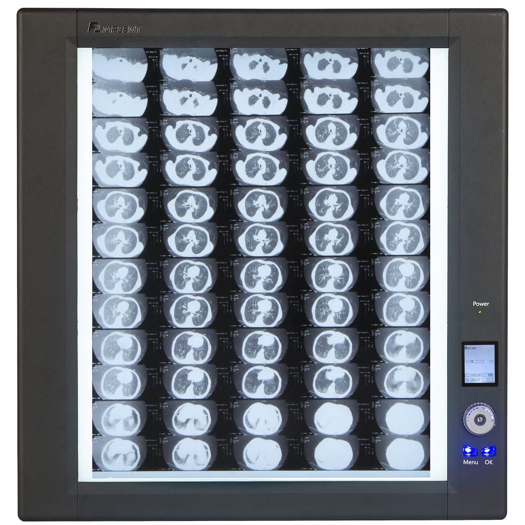 Negatoscopio digital - Trimline - Wolf X-Ray Corporation - 1 pantalla ...