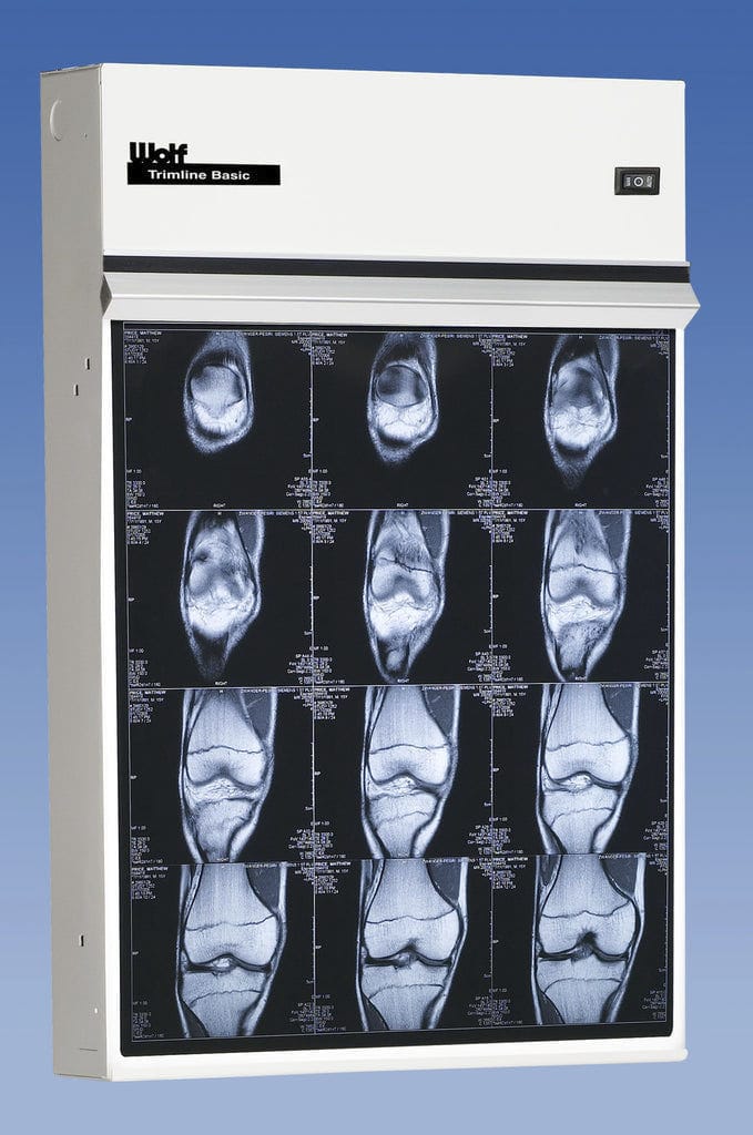 Negatoscopio estándar - Trimline Basic - Wolf X-Ray Corporation ...
