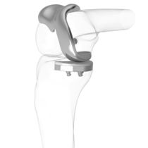 Prótesis de rodilla unicompartimental - Todos los fabricantes de ...