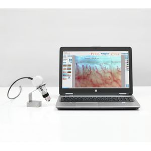 Capilaroscopio - Todos los fabricantes de dispositivos médicos