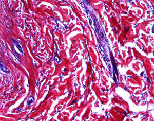 Kit de reactivos colorante - AB-PAS - Celnovte Biotechnology Co., Ltd ...