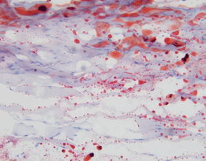 Kit de reactivos colorante - AB-PAS - Celnovte Biotechnology Co., Ltd ...