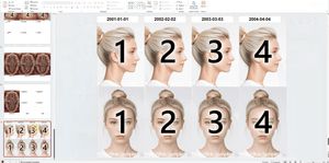 Software de edición de imágenes - photoalign - PhotoAlign - para odontología / clínico / de gestión