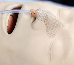 Fijador de catéter para catéter urinario - Wing Grip Foley - ACE ...