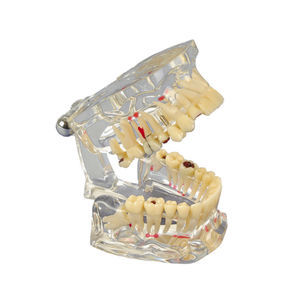 Modelo anatómico de mandíbula - 355651 - Hager & Werken - de dientes ...