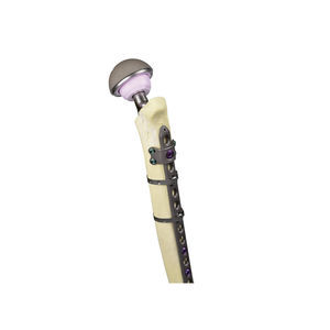 Placa de compresión para fémur - Vortex - Sanatmetal - para trocánter ...