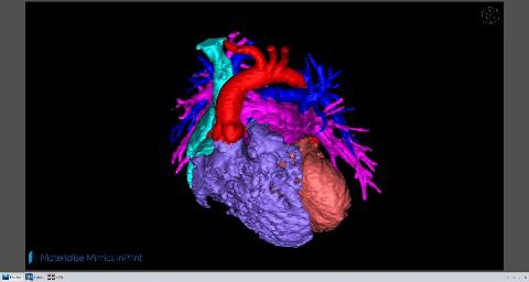 Software de impresión 3D - Mimics inPrint - Materialise UK - médico ...