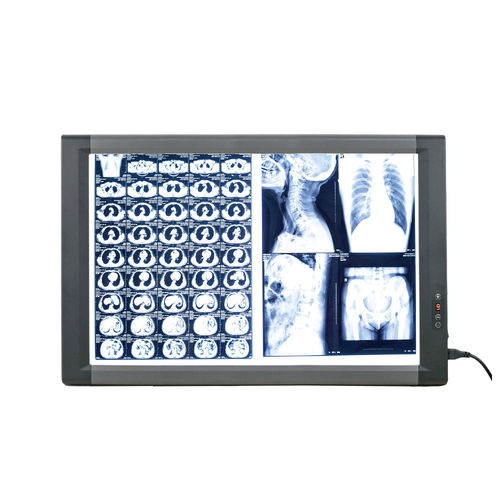 Negatoscopio digital - MG02 - Nanchang Micare Medical Equipment - 2 ...