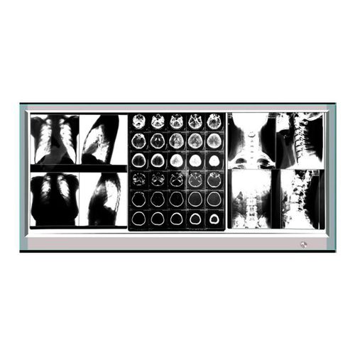 Negatoscopio 3 pantallas - GP1003A - Bellamoon Medical - LED